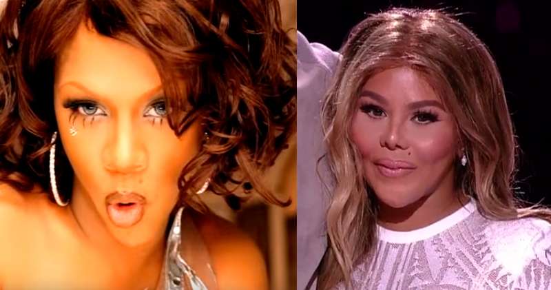 Deu errado! Influenciadora americana compartilha resultado de botox ...