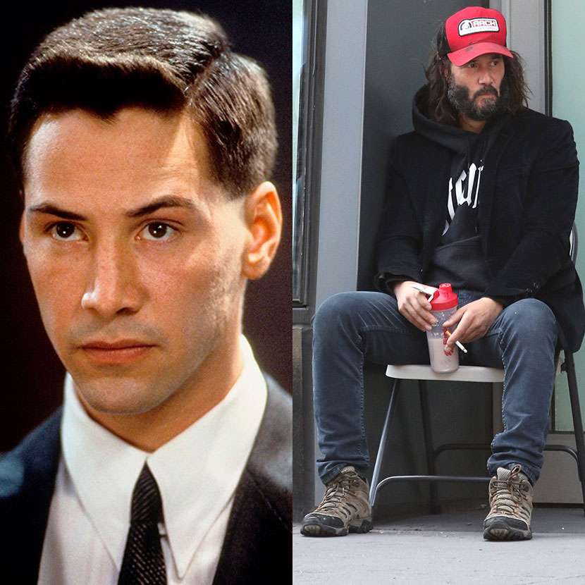 Deu errado! Influenciadora americana compartilha resultado de botox ...