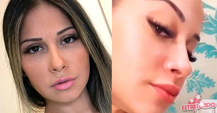 Mayra Cardi faz preenchimento nos lábios, tratamento com laser e coloca ...